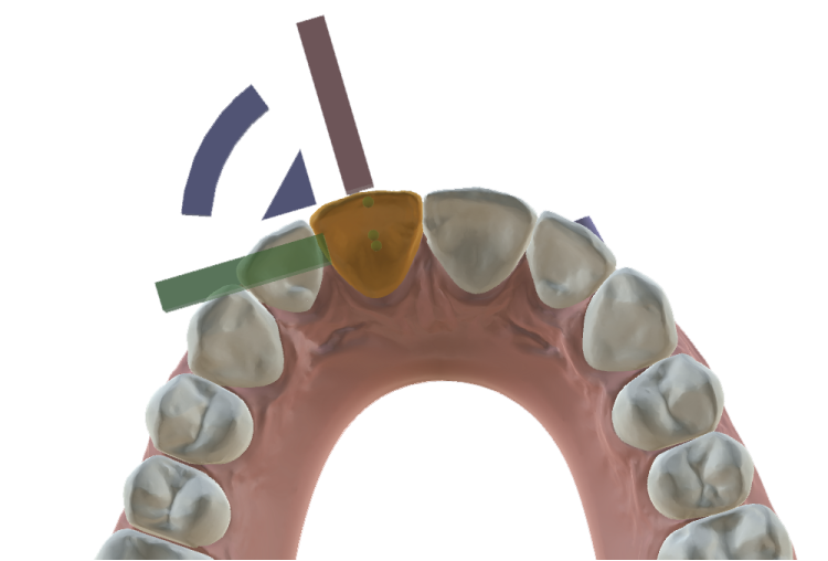 ArchForm - Simple, powerful 3D software to setup aligner cases